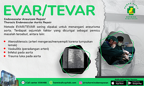 Hermina Hospitals | EVAR/TEVAR Methode